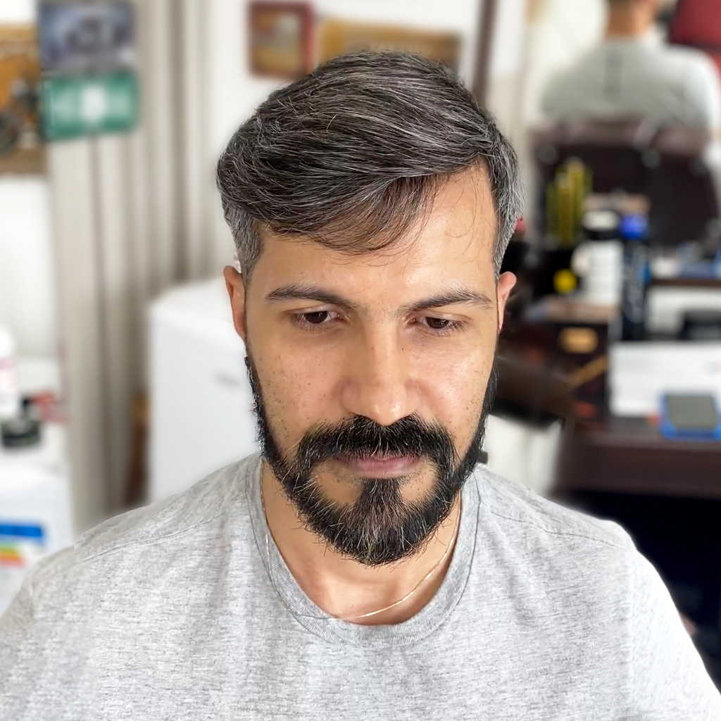 Injected Hair System 0.12 mm Poly from the Genuine Supplier