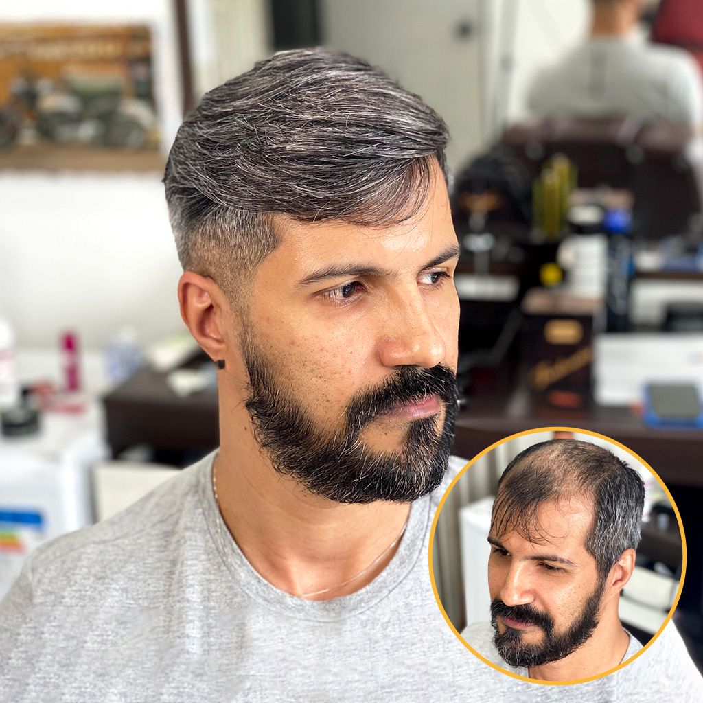 Injected Hair System 0.12 mm Poly from the Genuine Supplier